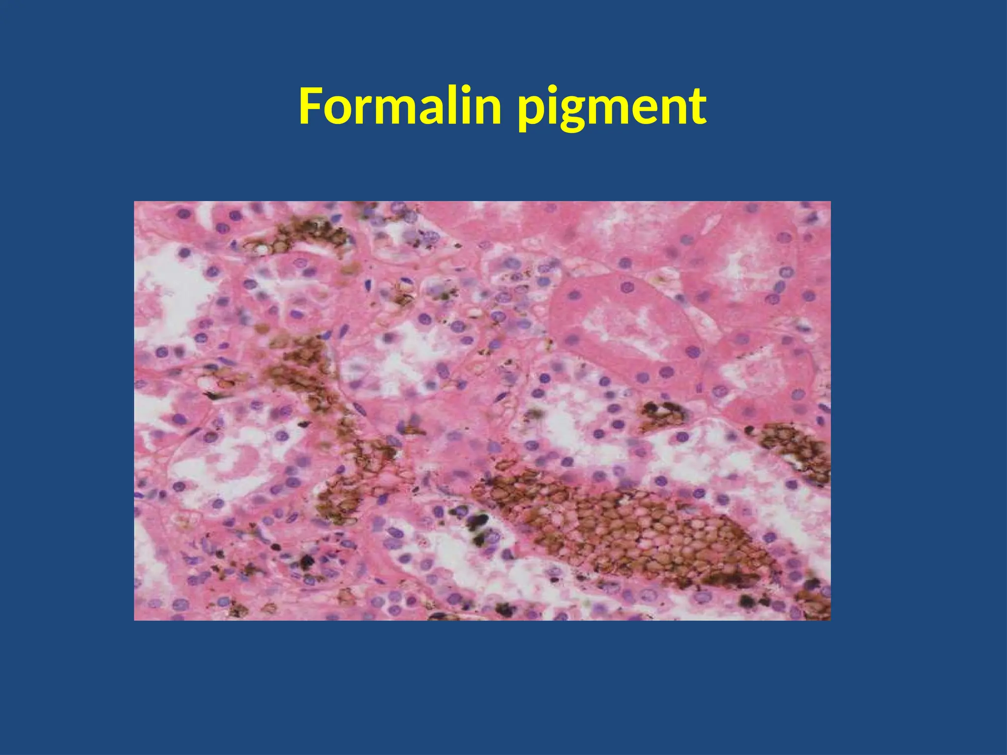 pigment and its stain in histopathology.pptx