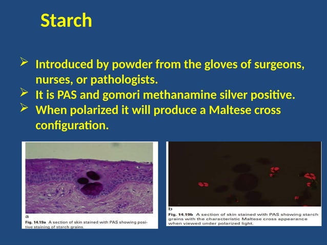 pigment and its stain in histopathology.pptx