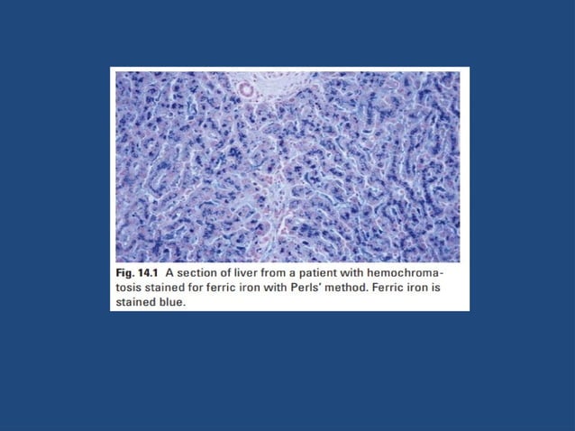 pigment and its stain in histopathology.pptx