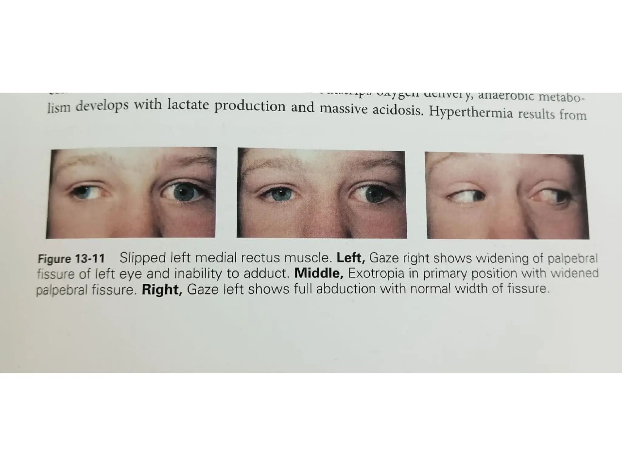 Eye education, Opthalmology, Health power point | PPTX