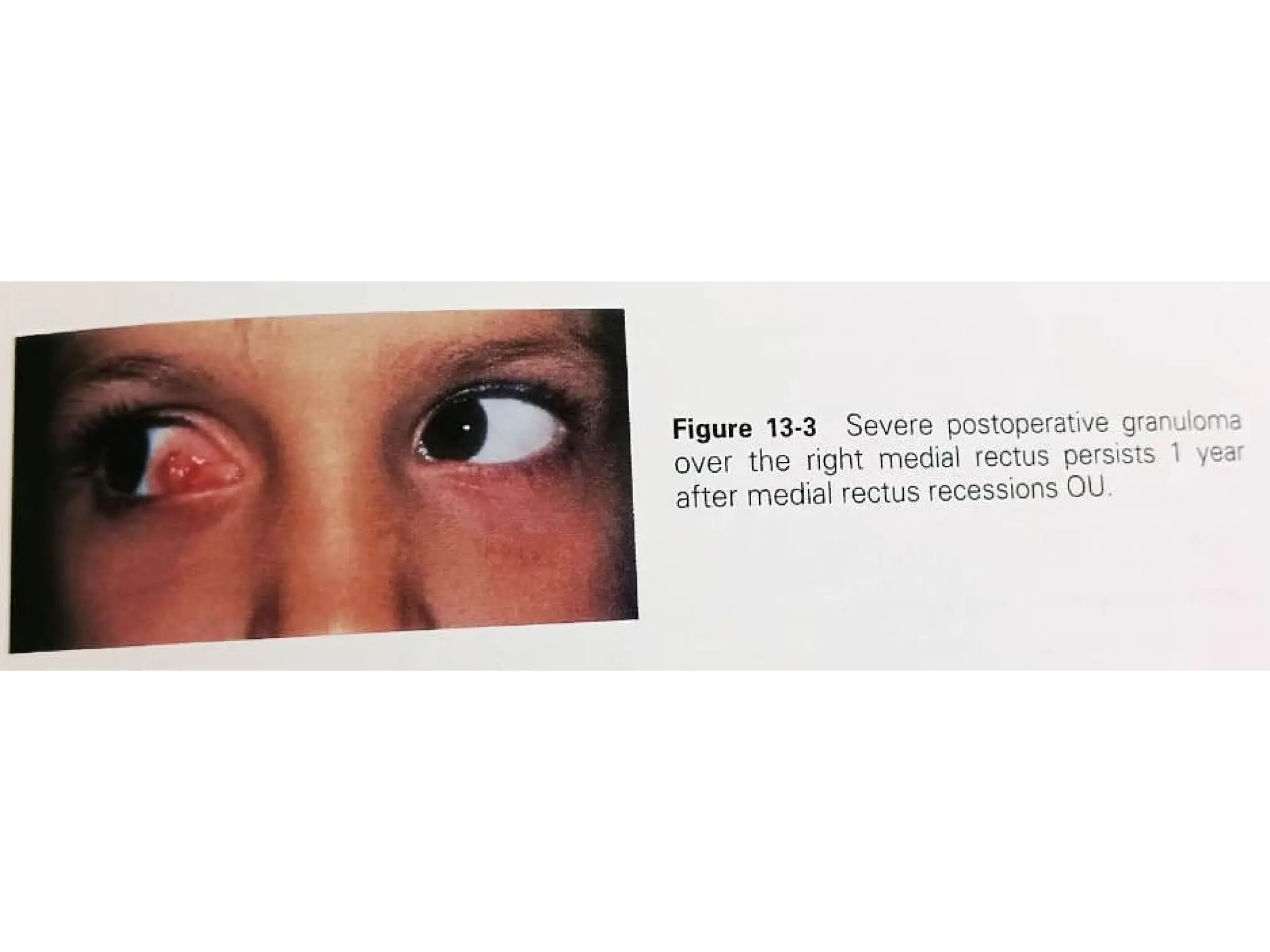 Eye education, Opthalmology, Health power point | PPTX