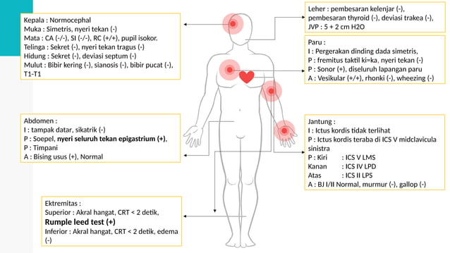 demam berdarah dengue danpenannganannnya | PPT