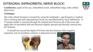 Oral and maxillofacial surgery -extra oral nerve blocks | PPT