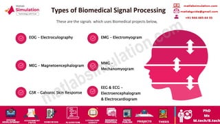 Biomedical Signal Processing Projects Research Guidance | PPT