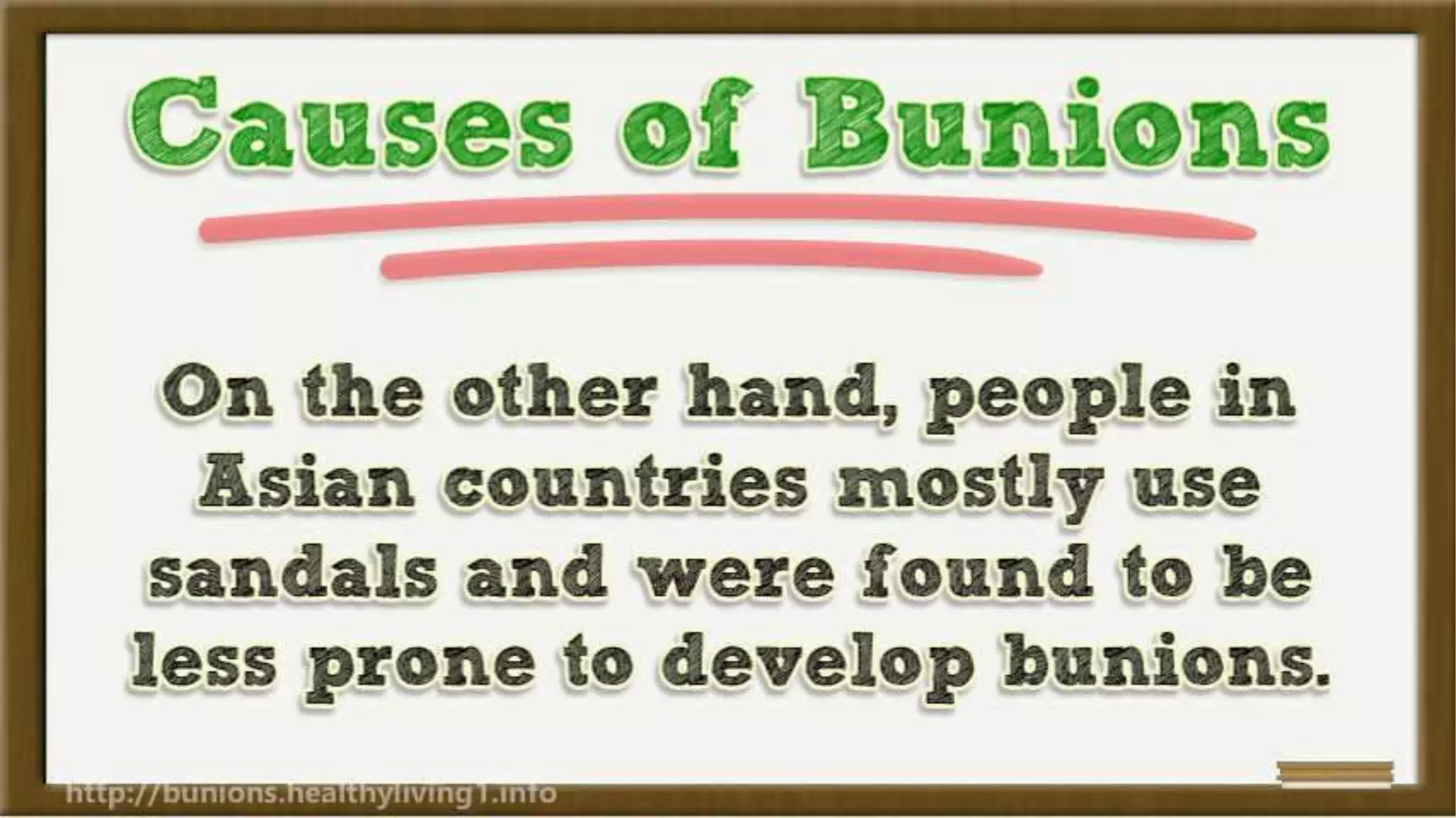 Bunions: Causes, Prevention and Bunion Treatment | PPT