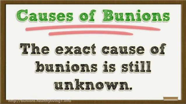 Bunions: Causes, Prevention and Bunion Treatment | PPT