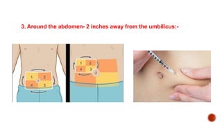 PPT-Administration-of-Subcutaneous-Injection-.pptx.ppt