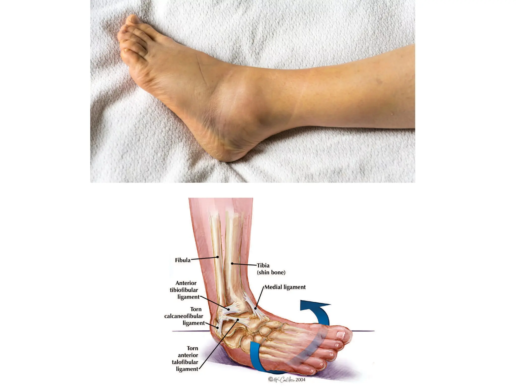 Ppt- axial and appendicular skeleton, injection sites | PPT | Free Download