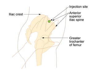 Ppt- axial and appendicular skeleton, injection sites | PPTX