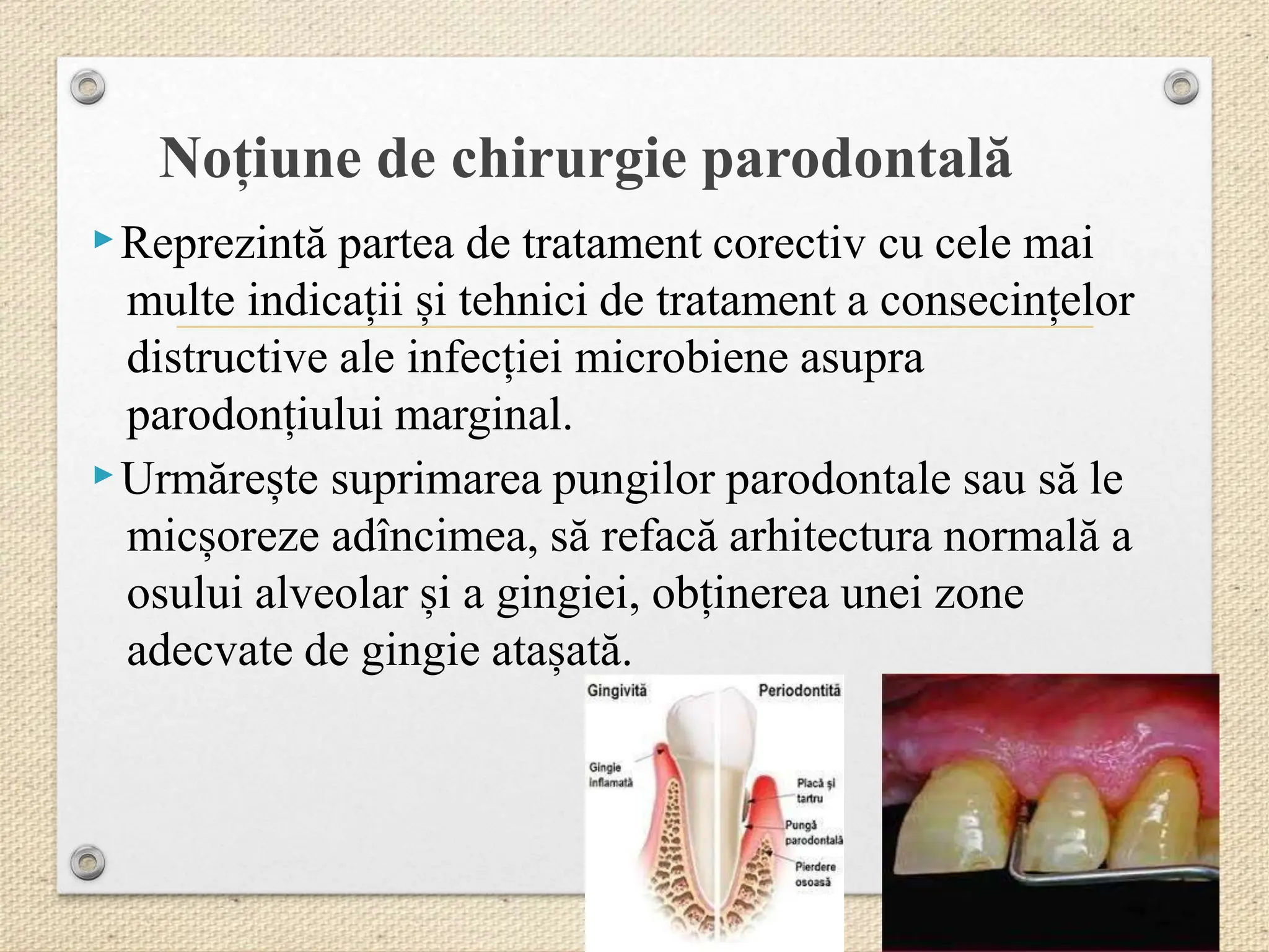 ppt-chirurgie.........................pptx