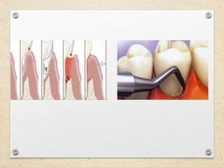 ppt-chirurgie.........................pptx