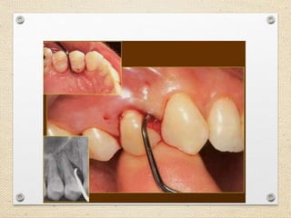 ppt-chirurgie.........................pptx