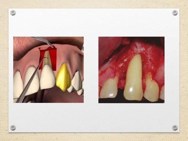 ppt-chirurgie.........................pptx