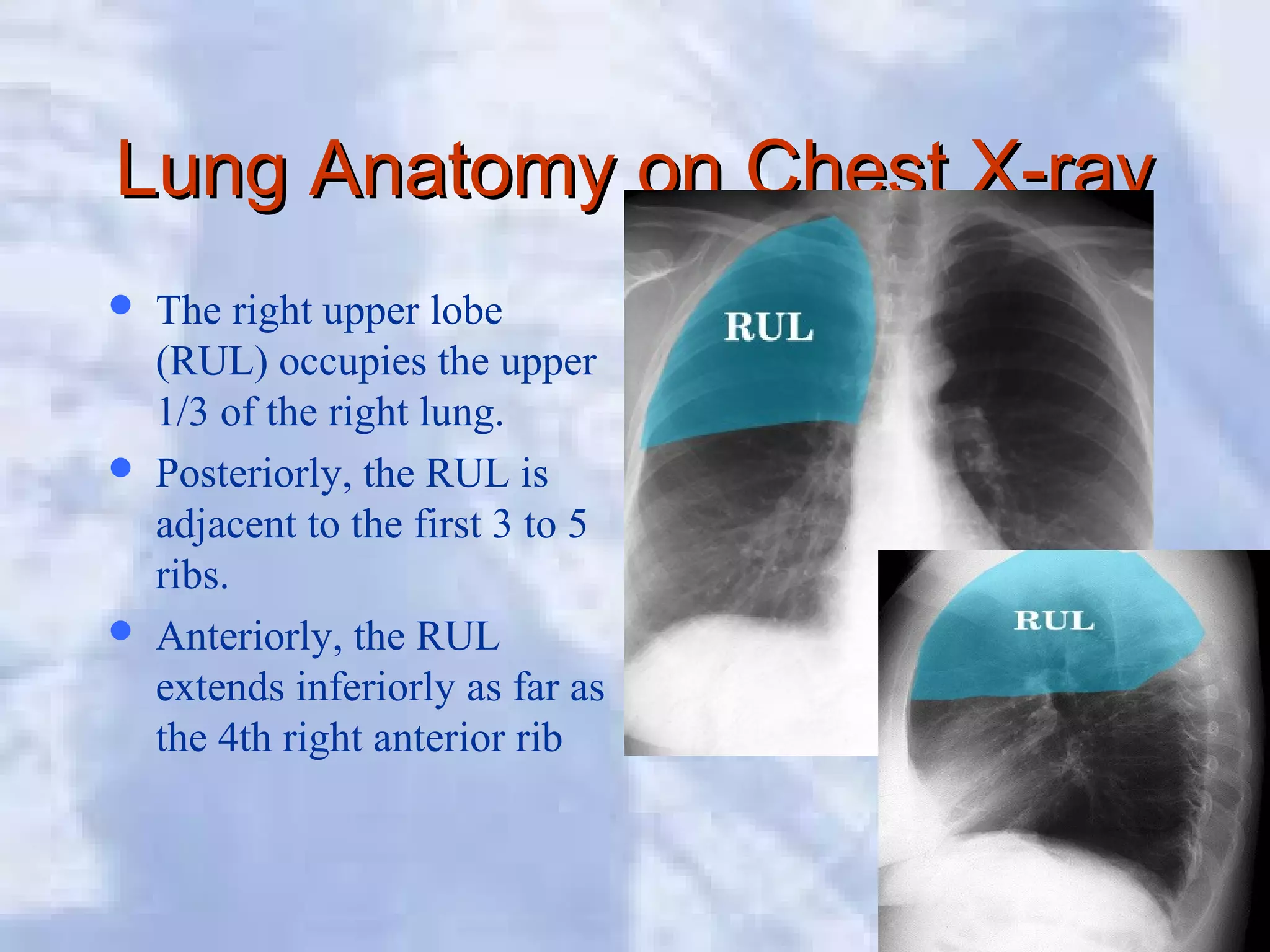 HOW TO READ CXR | PPT