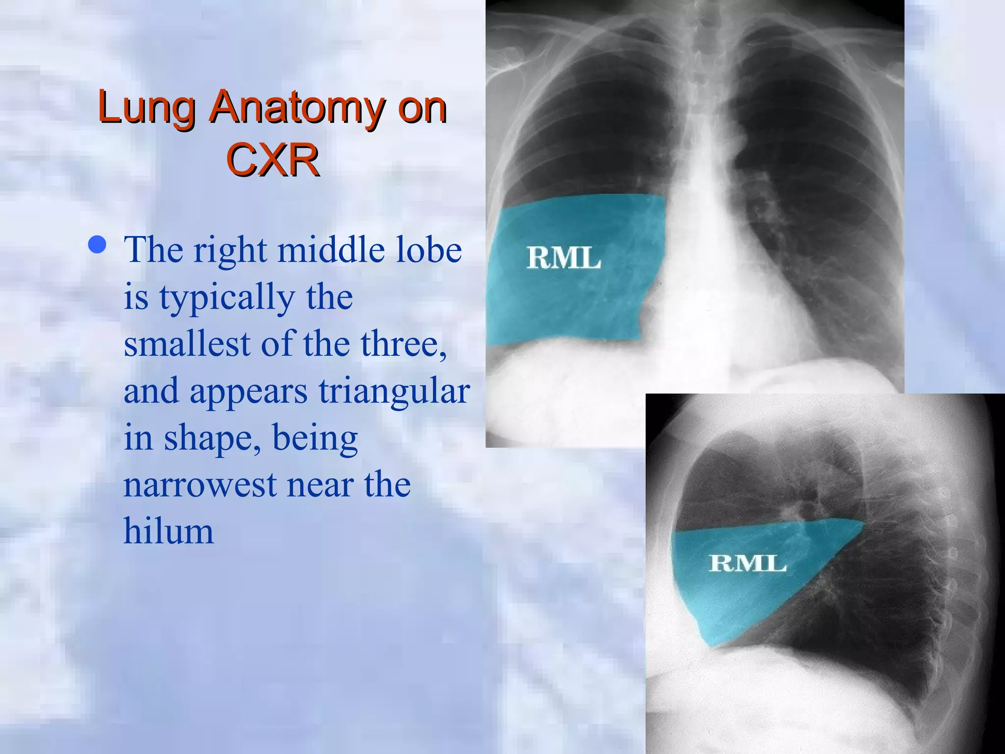 HOW TO READ CXR | PPT