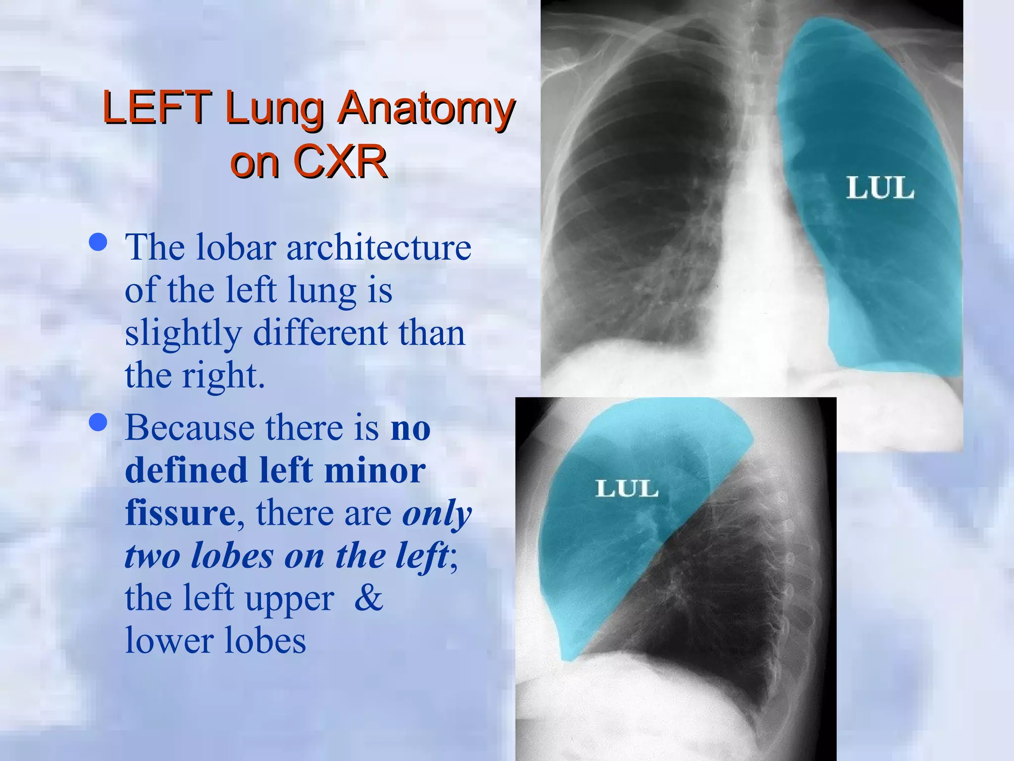 HOW TO READ CXR | PPT