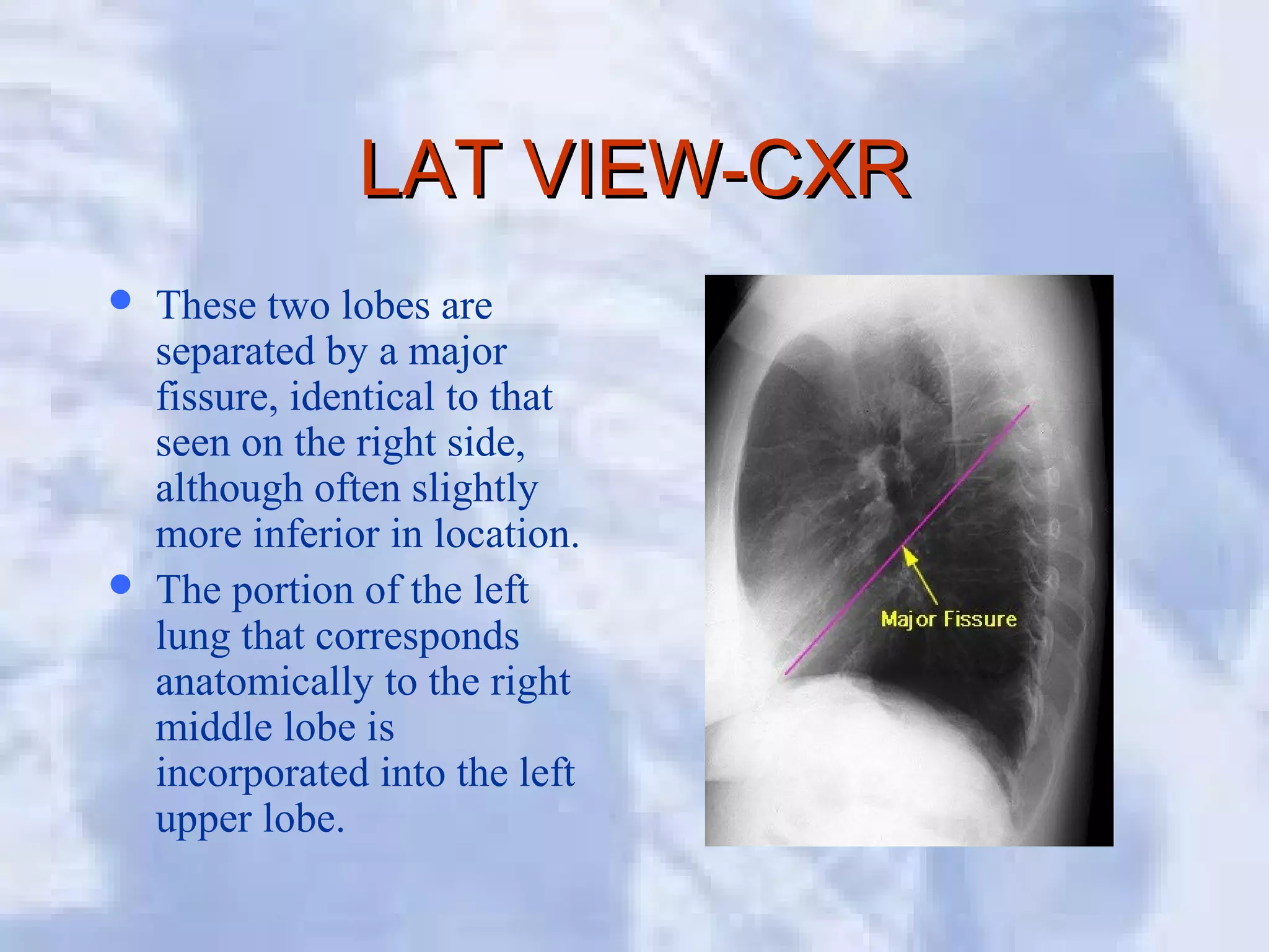 HOW TO READ CXR | PPT