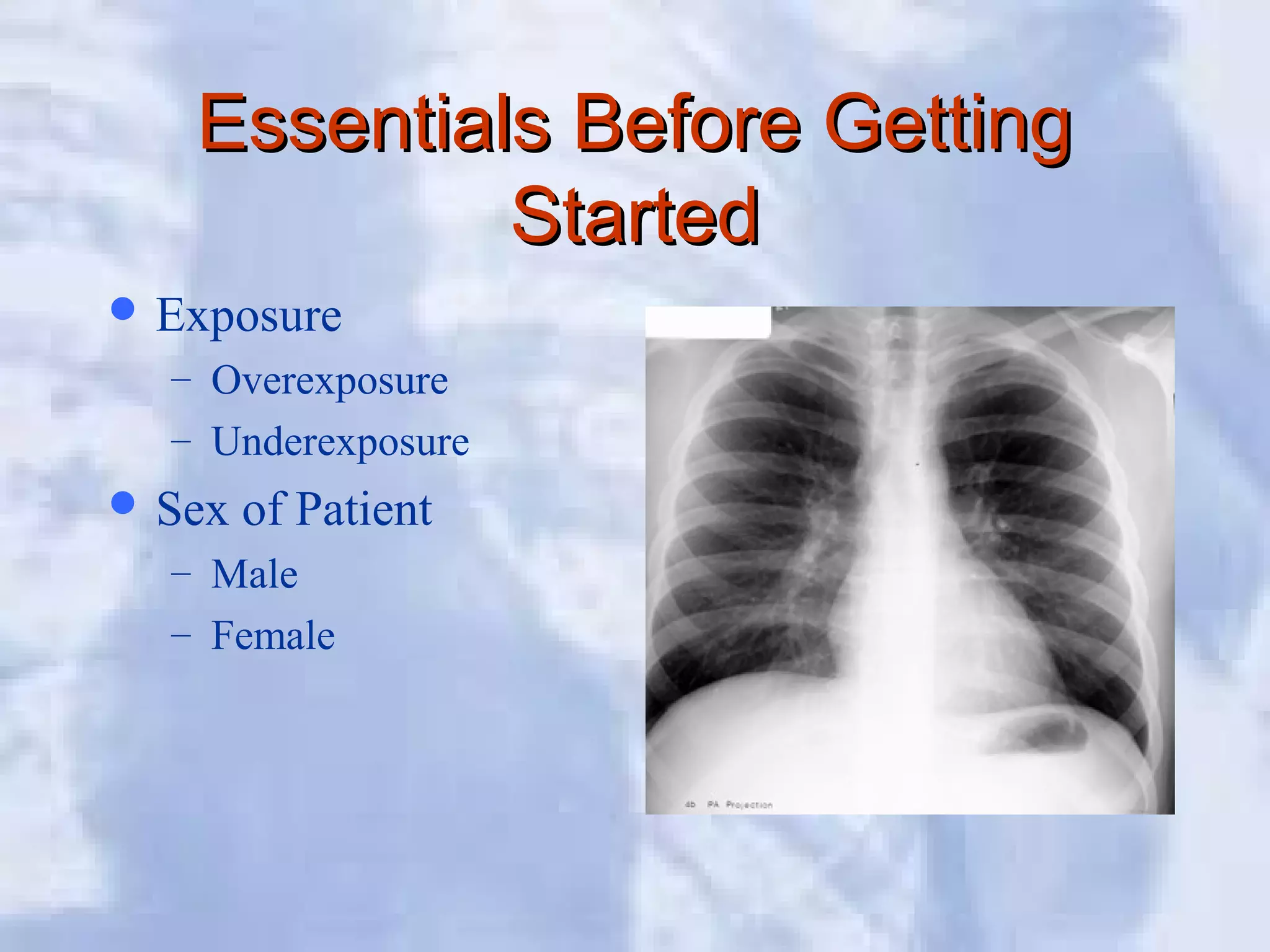 HOW TO READ CXR | PPT