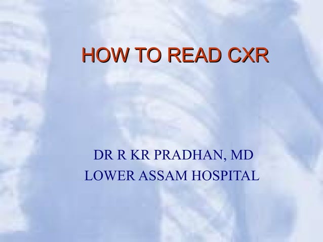 HOW TO READ CXR | PPT