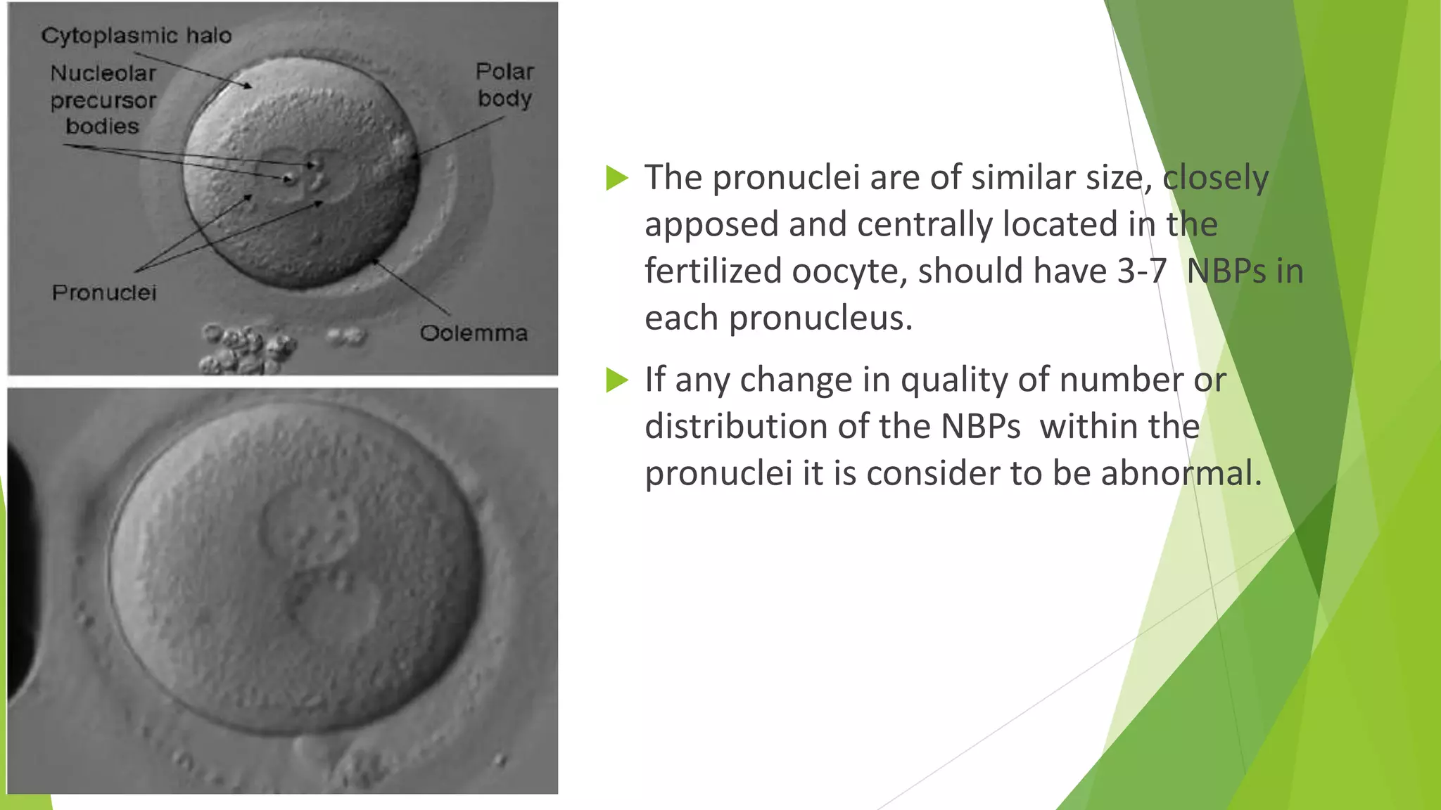PPT-Embryo grading and ART Summary.pptx