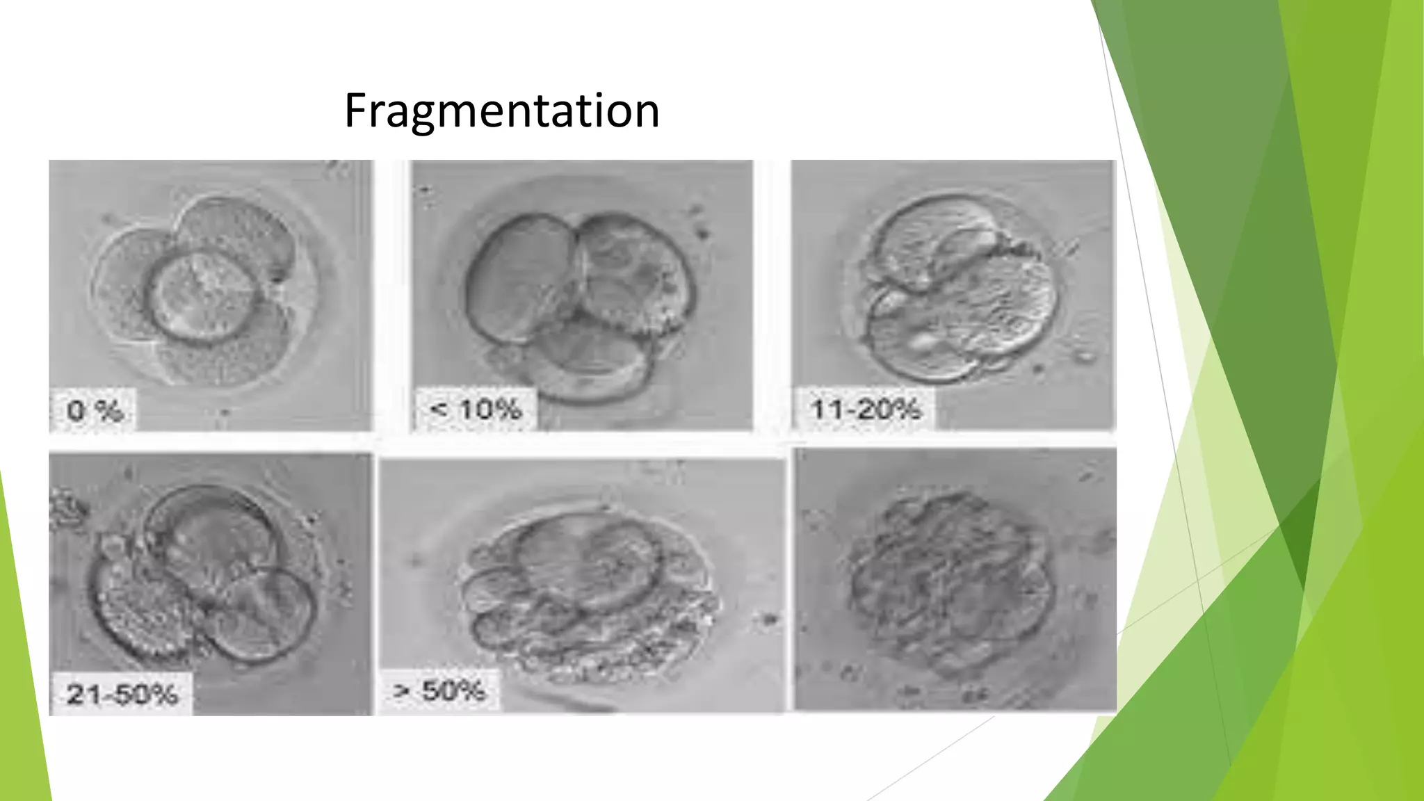 PPT-Embryo grading and ART Summary.pptx