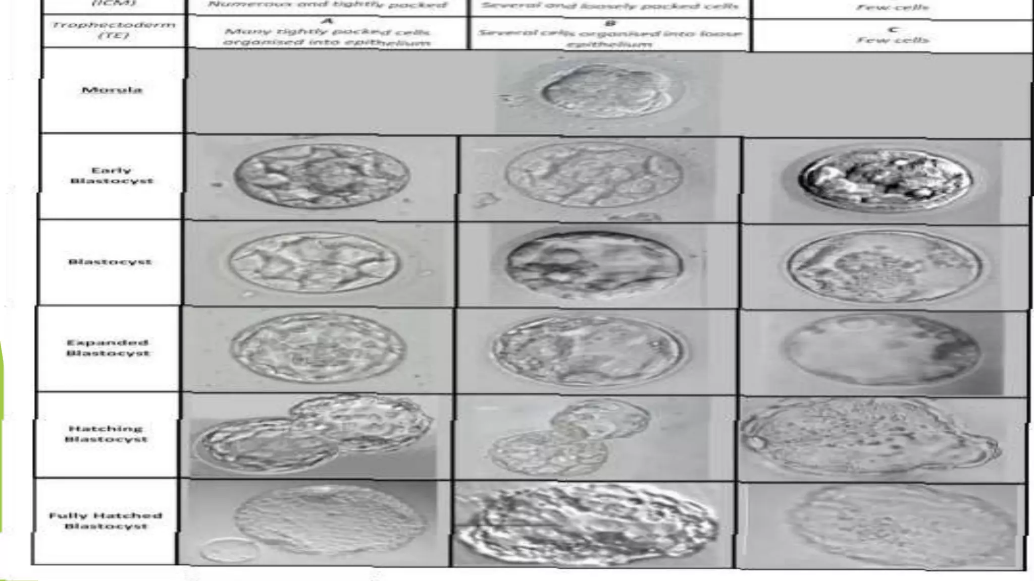 PPT-Embryo grading and ART Summary.pptx