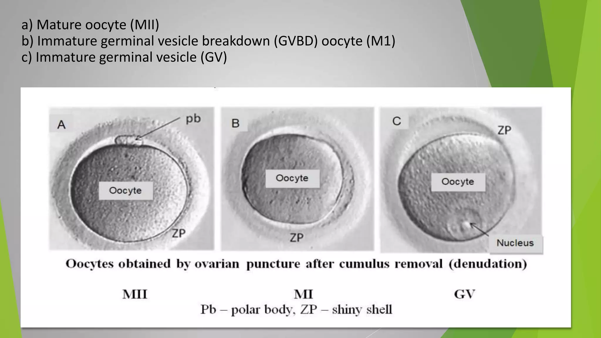PPT-Embryo grading and ART Summary.pptx