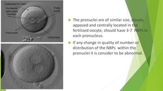 PPT-Embryo grading and ART Summary.pptx