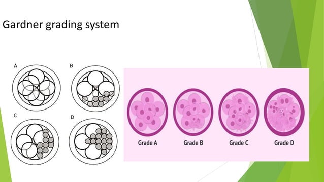 PPT-Embryo grading and ART Summary.pptx | Pregnancy | Reproductive Health