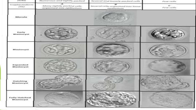 PPT-Embryo grading and ART Summary.pptx | Pregnancy | Reproductive Health