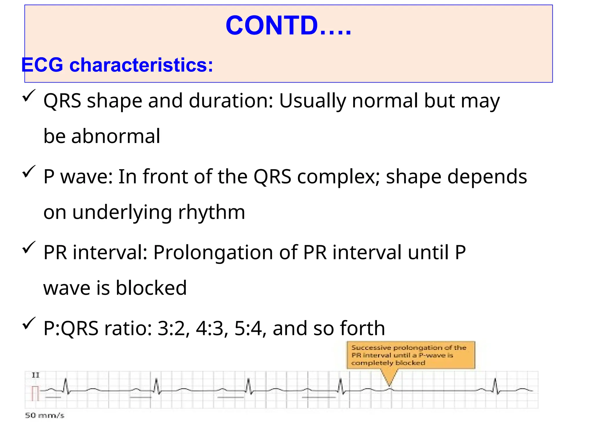 PPT-HEART-BLOCK.pptx cardiovascular disorder | PPTX
