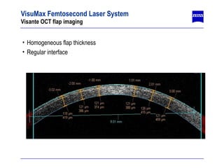 VisuMax Femtosecond Laser System The triangle of treatment parameters | PPT