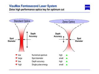 VisuMax Femtosecond Laser System The triangle of treatment parameters | PPT