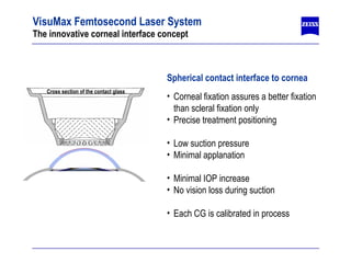 VisuMax Femtosecond Laser System The triangle of treatment parameters | PPT