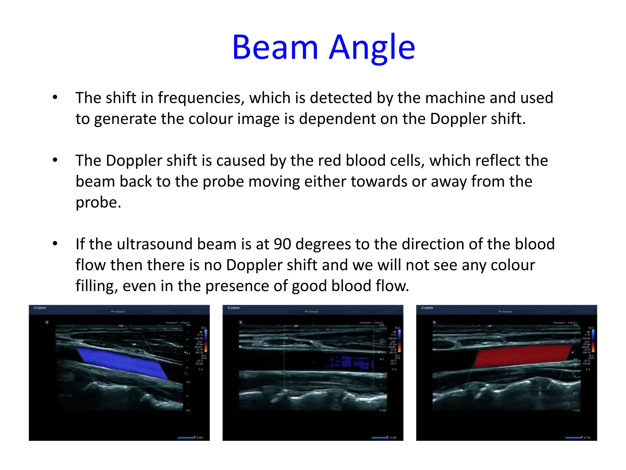 PPT-Matt-Bartlett-vascular doppler of lower limb | PDF