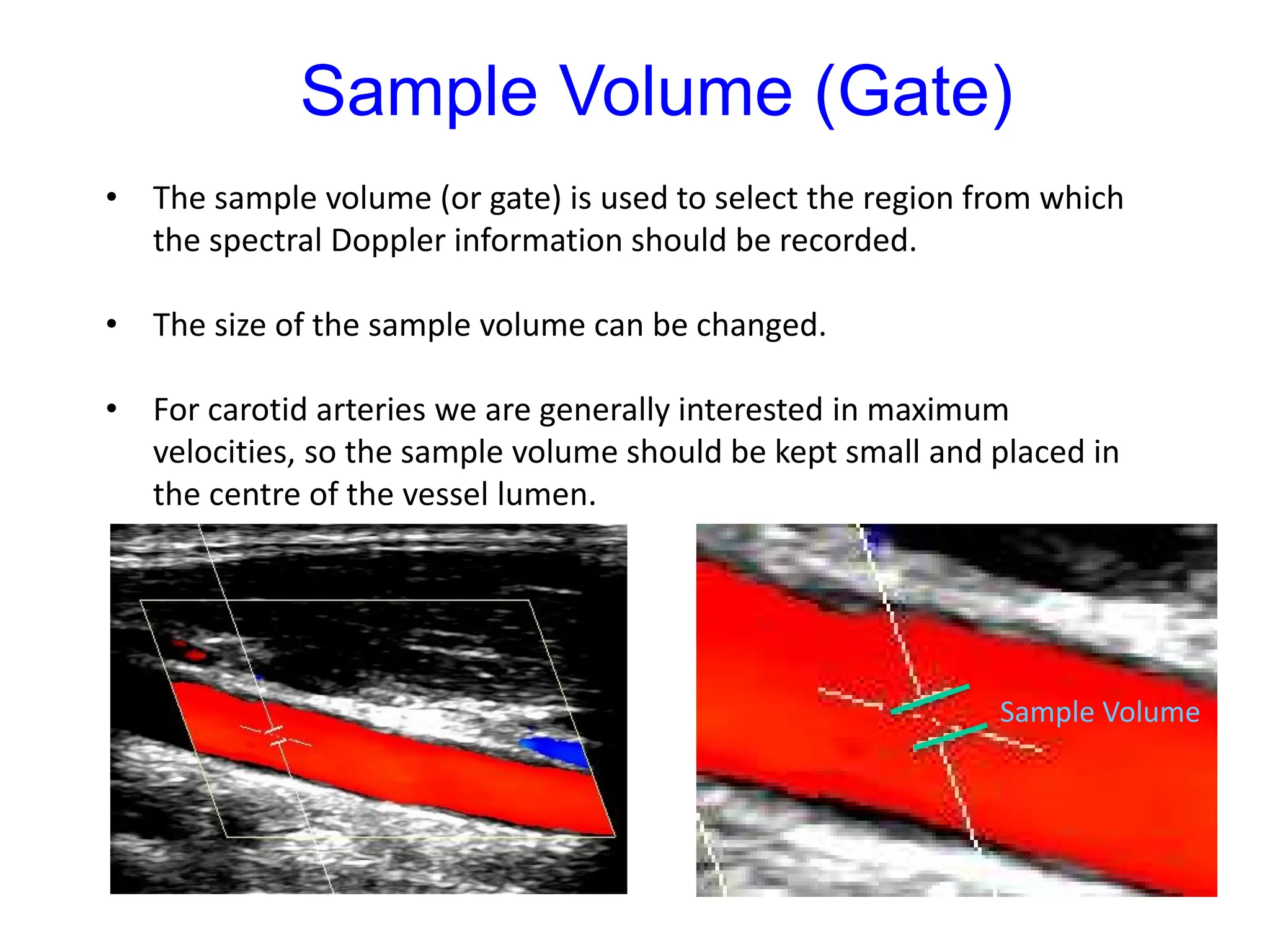 PPT-Matt-Bartlett-vascular doppler of lower limb | PDF