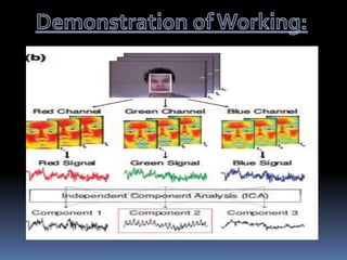 Medical mirror | PPTX