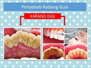 ppt-pelatihan-kader.pptx