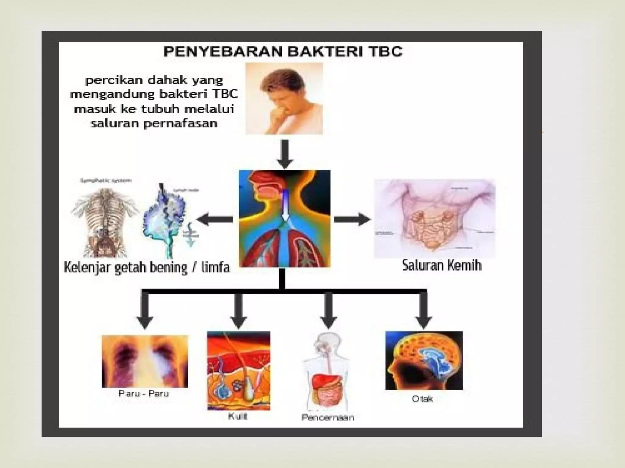 Ppt penyuluhan-tbc | PPT
