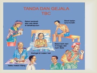 Ppt penyuluhan-tbc | PPT