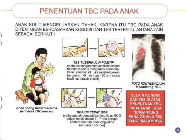 Ppt penyuluhan-tbc | PPT