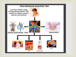 Ppt penyuluhan-tbc | PPT