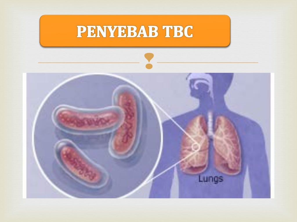Ppt penyuluhan-tbc