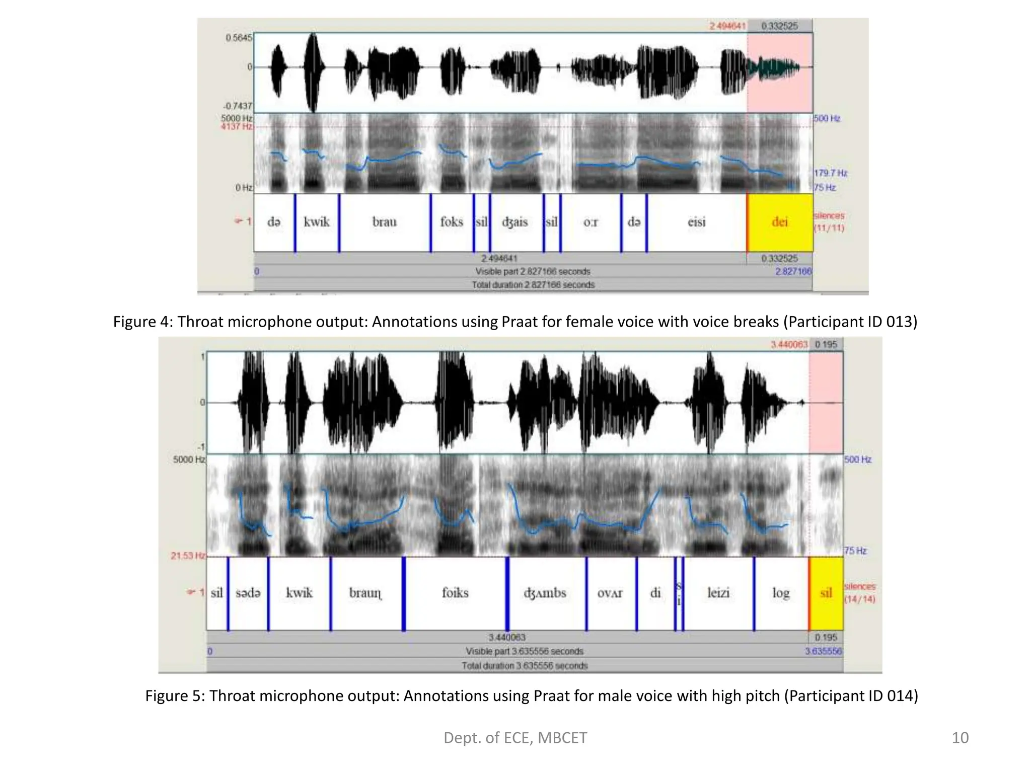 ppt-Piezoelectric Throat Microphone Based Voice Analysis.pptx