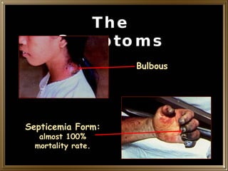 Plague And Hundred Years War | PPT