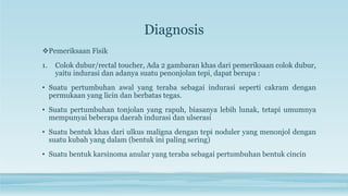 Ppt-Referat-Bedah-CA-Recti.pptx untuk belajar | PPTX