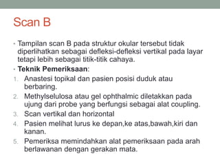 ppt-referat-usg-mata.pptx