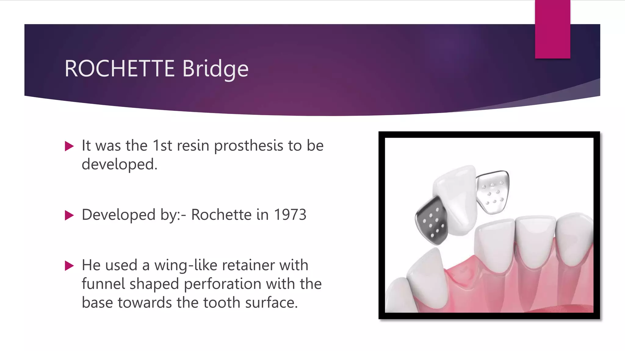 Resin bonded FPD | PPTX