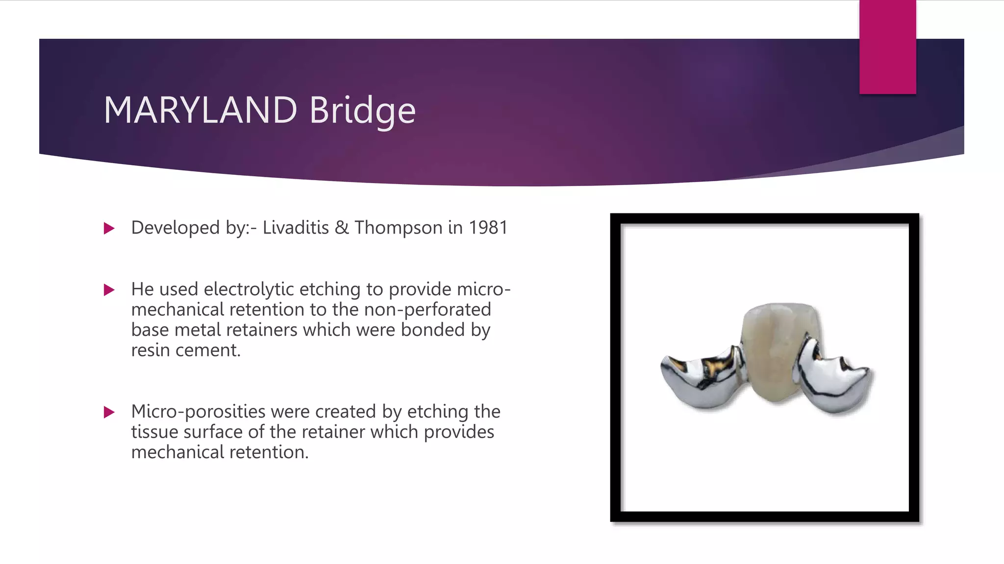 Resin bonded FPD | PPTX
