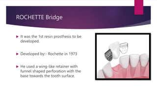 Resin bonded FPD | PPTX